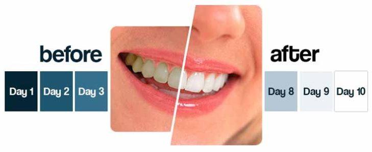 5 Best Charcoal Toothpastes (updated Review 2021) - DentalsReview