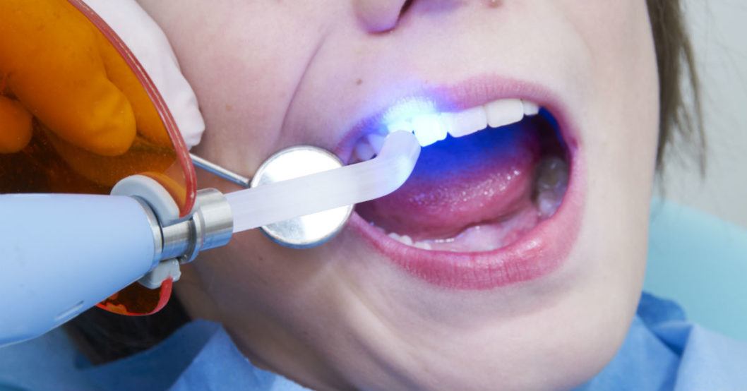 What is Oral Hygiene and Why is it Important? - DentalsReview