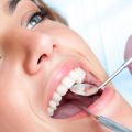 Clicking Teeth: What Causes It and How to Fix It - DentalsReview