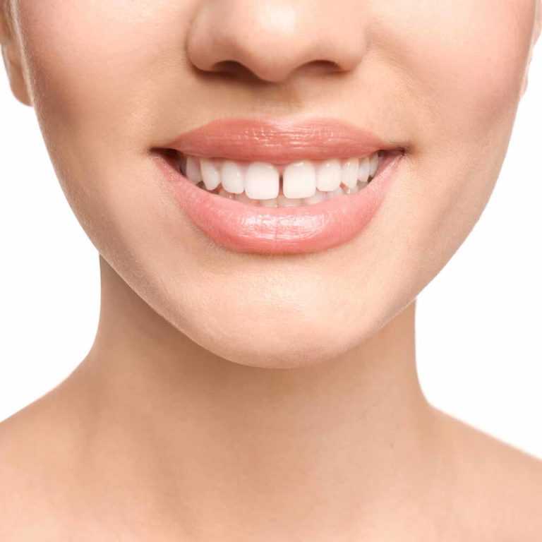 Why Teeth Turn Transparent: Causes and Treatment Options - DentalsReview