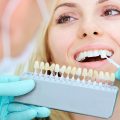 Why Silver Teeth? The Fascinating Reasons Behind This Dental Trend ...