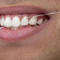Why Do My Teeth Tingle? Understanding the Causes and Treatment Options ...