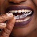 Proper Teeth Resting Position: Tips for Maintaining Optimal Dental ...