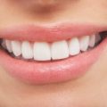 Why Do My Teeth Tingle? Understanding the Causes and Treatment Options ...